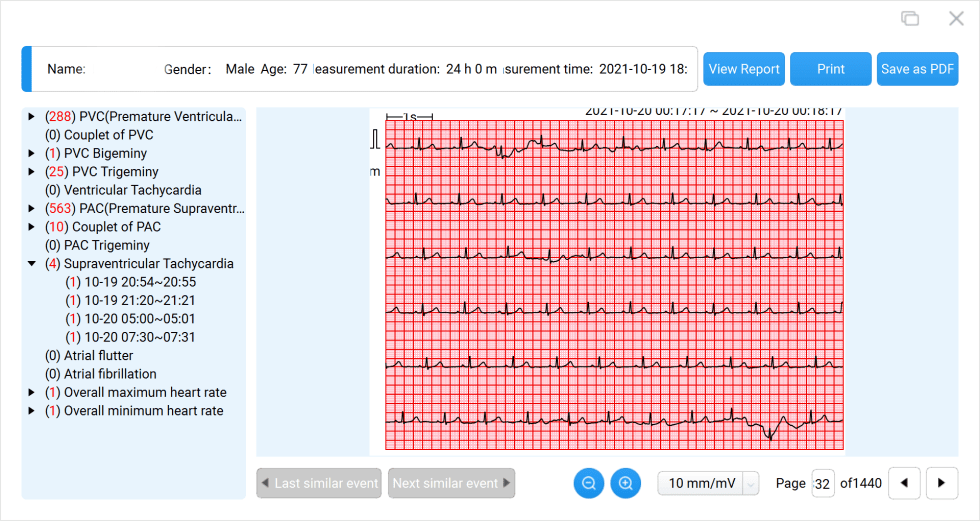 Wellue AI ECG Recorder Review From Dr. Petar | Wellue Blog