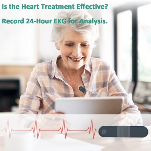 AI ECG recorder | Wellue Blog