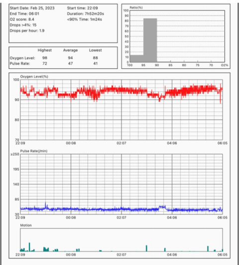 Wellue O2 Ring | Wellue Blog